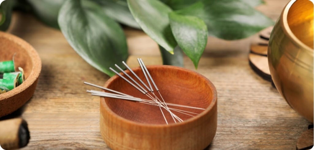Acupuncture : un art thérapeutique ancestral au service de votre bien ...